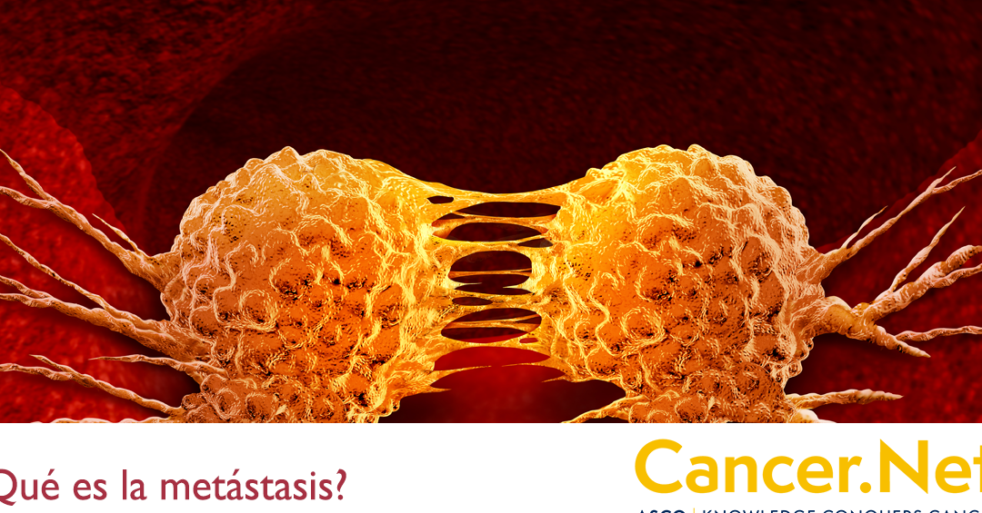 Cáncer que hace engordar: ¿Cómo influye la enfermedad en nuestro peso ...